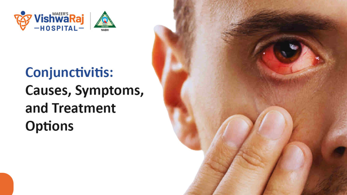 Conjunctivitis Causes Symptoms and Treatment Options. – Best Hospital ...