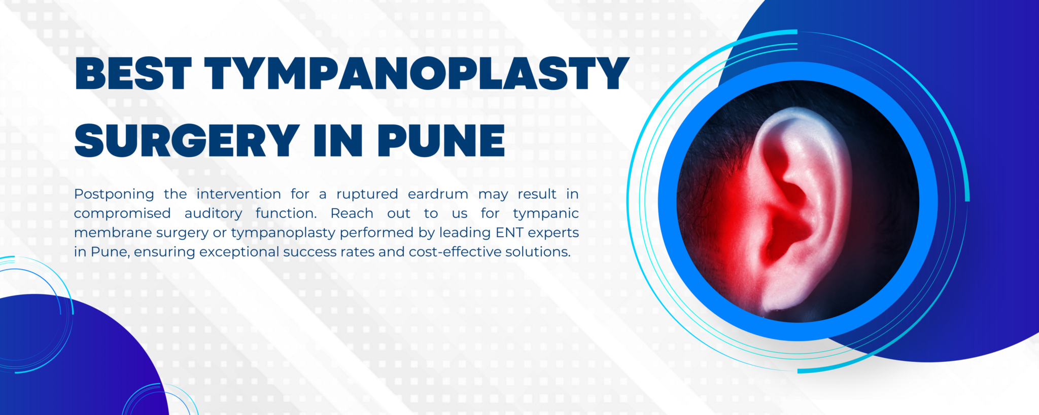 Best Tympanoplasty Surgery In pune – Best Hospital in Pune MAEER'S ...